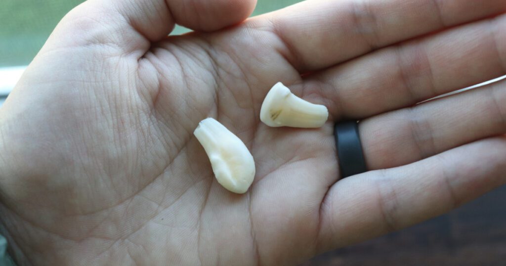 How to Clean Elk Teeth - Explore the Best Outdoor Gear, Animal Guides ...